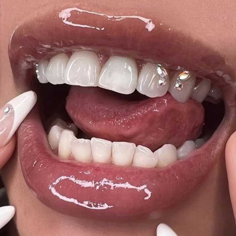 Tooth Gem Boston Services | Holistic Ink