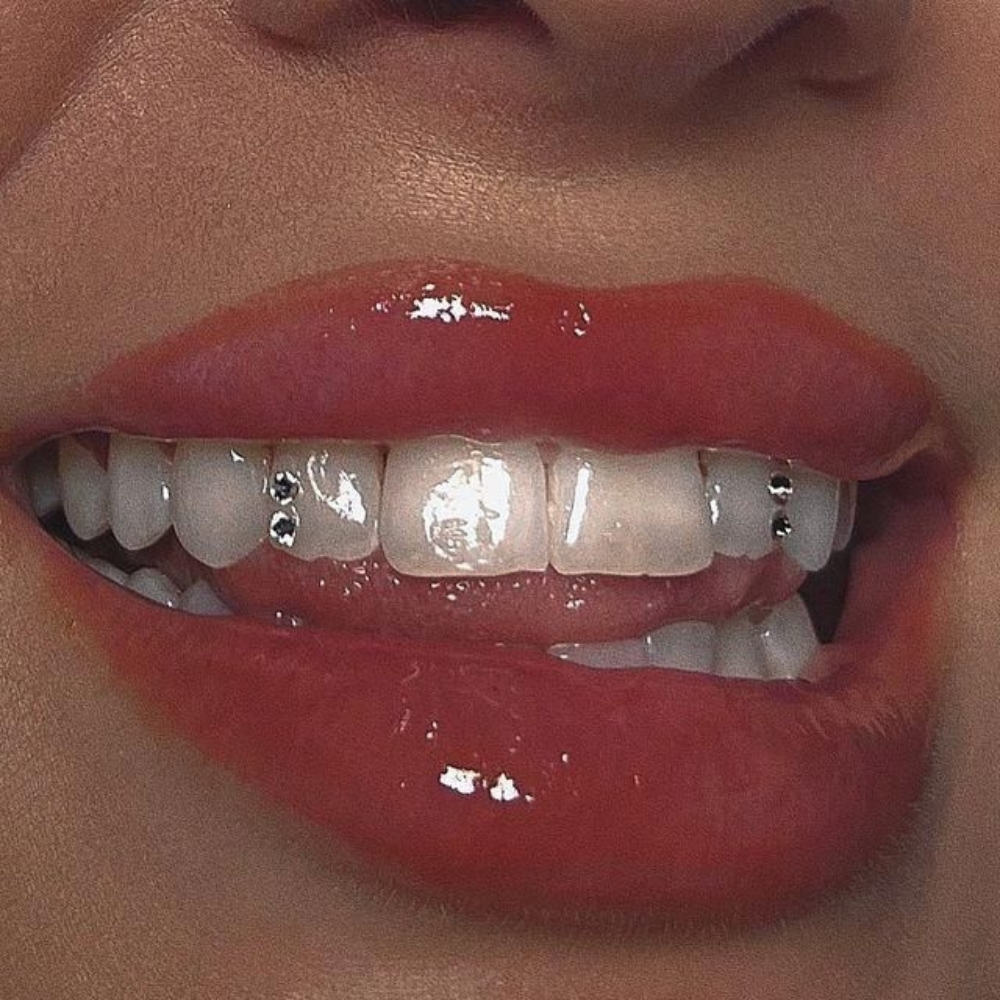 Tooth Gem Boston Services | Holistic Ink